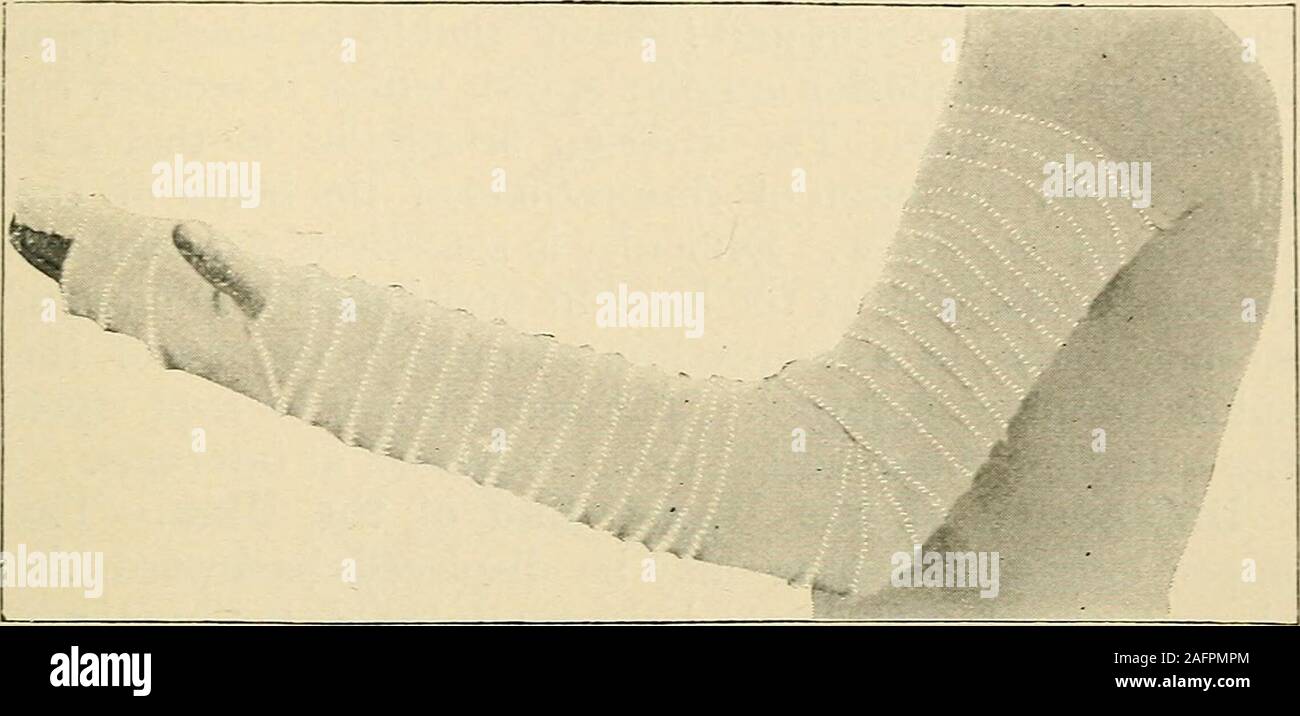 . Minor surgery and bandaging; including the treatment of fractures and ...