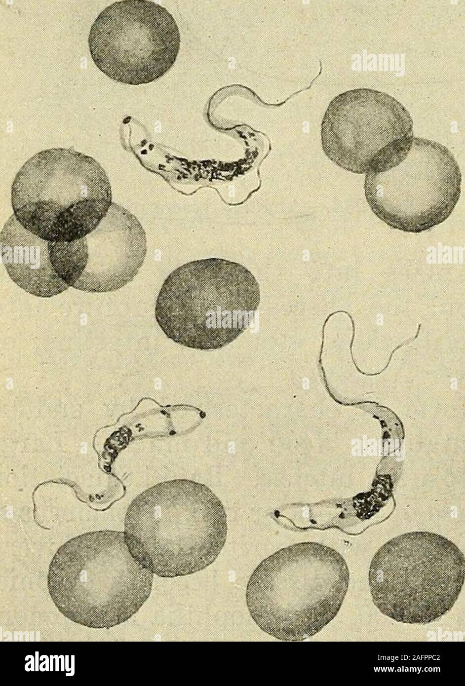 Undulant hi-res stock photography and images - Alamy