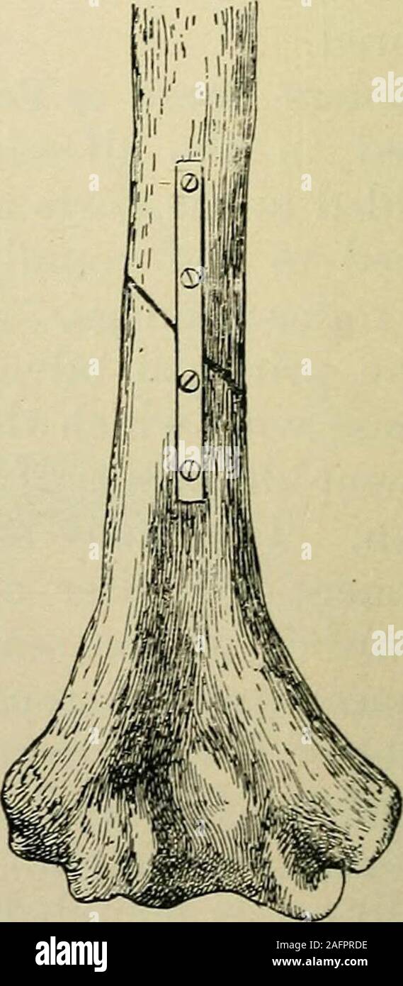 . Minor surgery and bandaging; including the treatment of fractures and ...