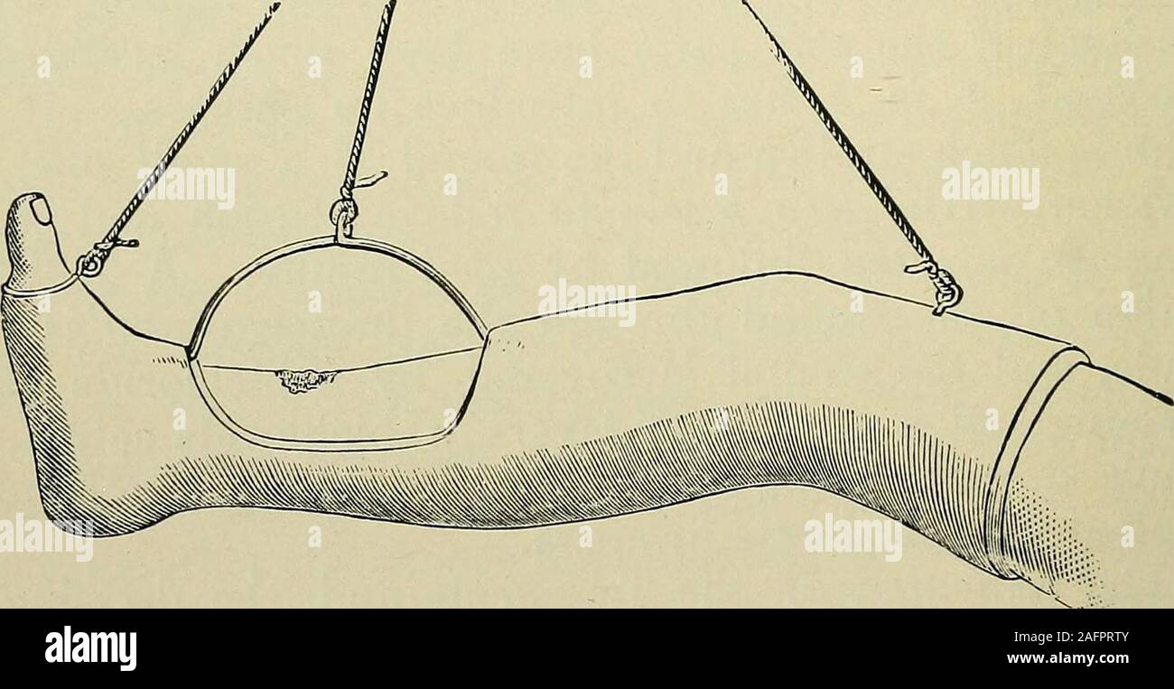 . Minor surgery and bandaging; including the treatment of fractures and ...