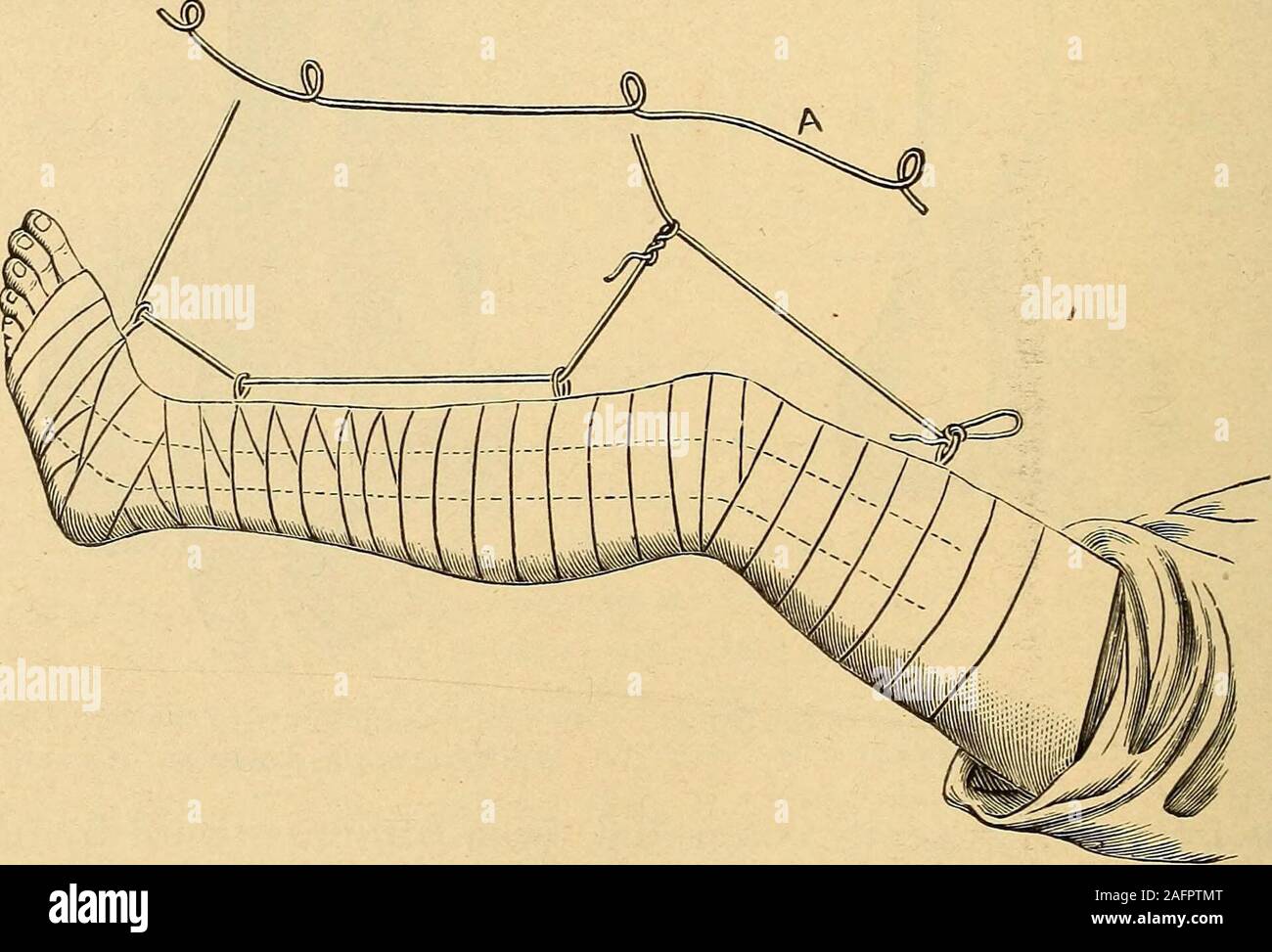 Stiff suspension hi-res stock photography and images - Alamy