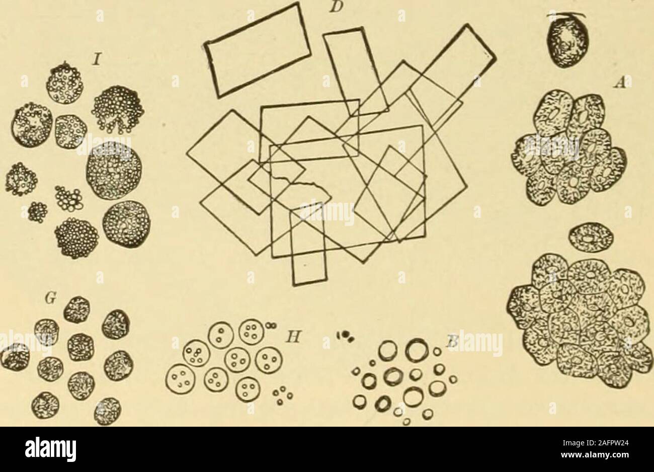 . Clinical gyncology, medical and surgical. Microscopical appearance of ...