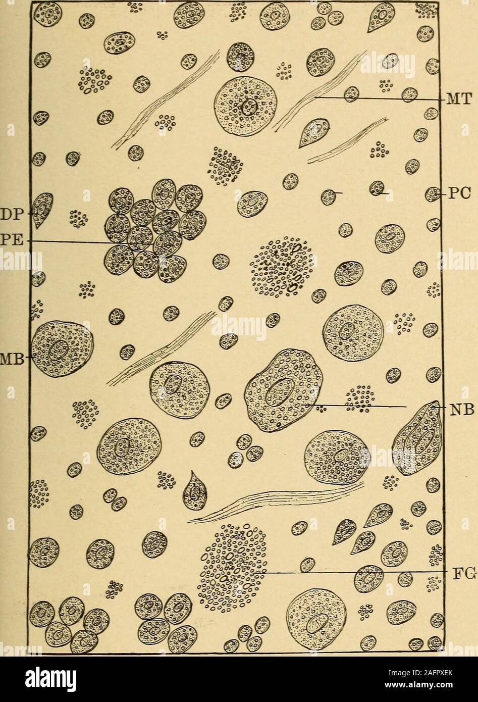 White Mucus In Urine