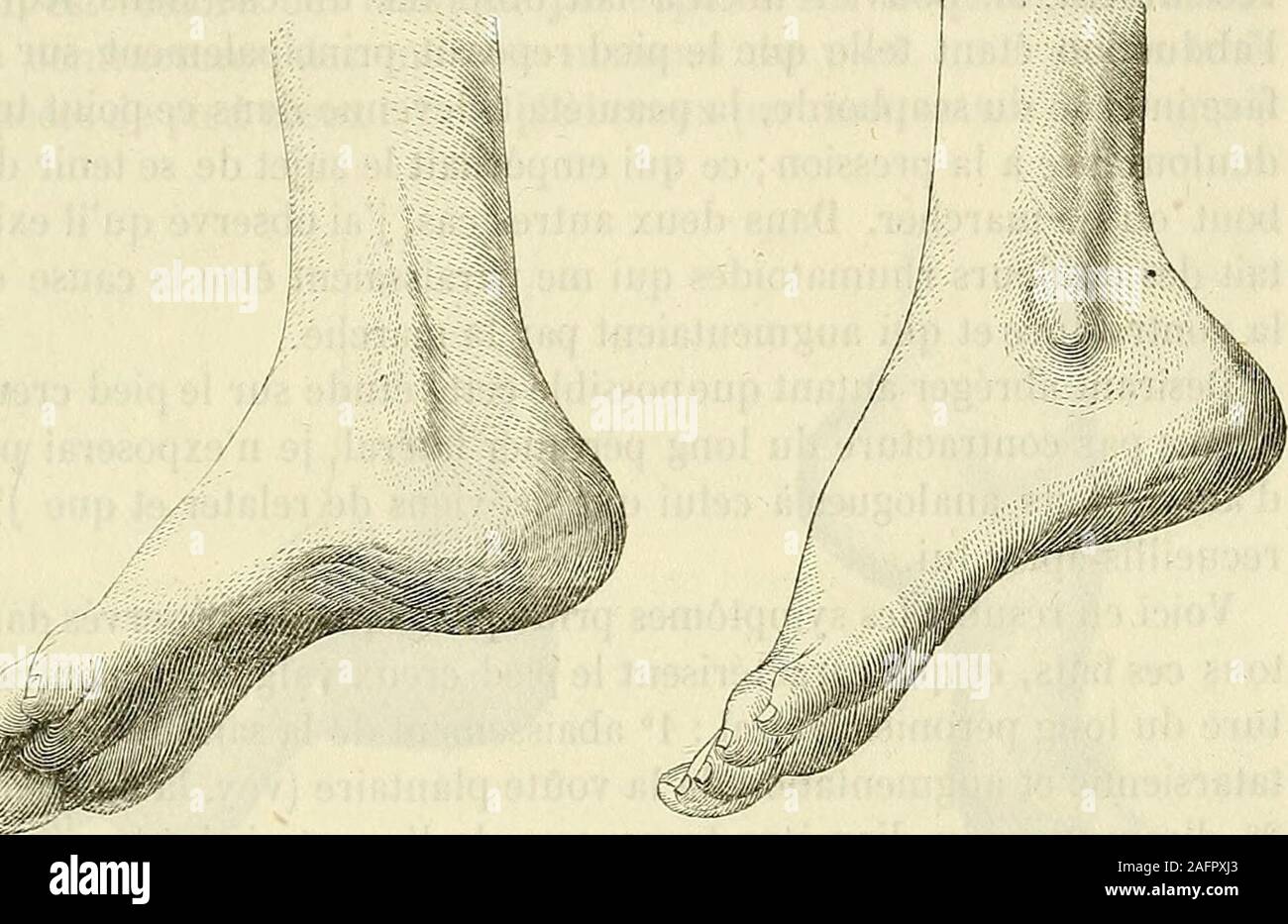 Sopposait hi-res stock photography and images - Alamy