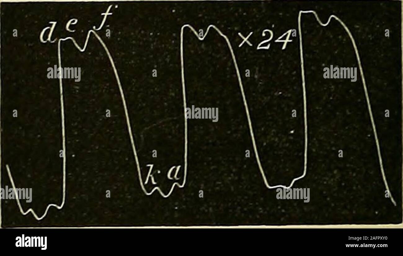 . Diseases of the heart and thoracic aorta. Fig. 190. Fig. 191. Fig ...
