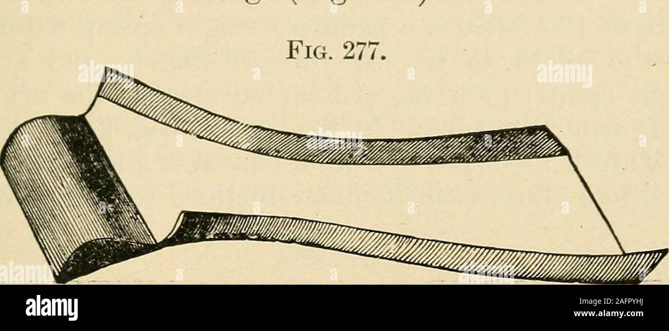 . Minor surgery and bandaging; including the treatment of fractures and ...