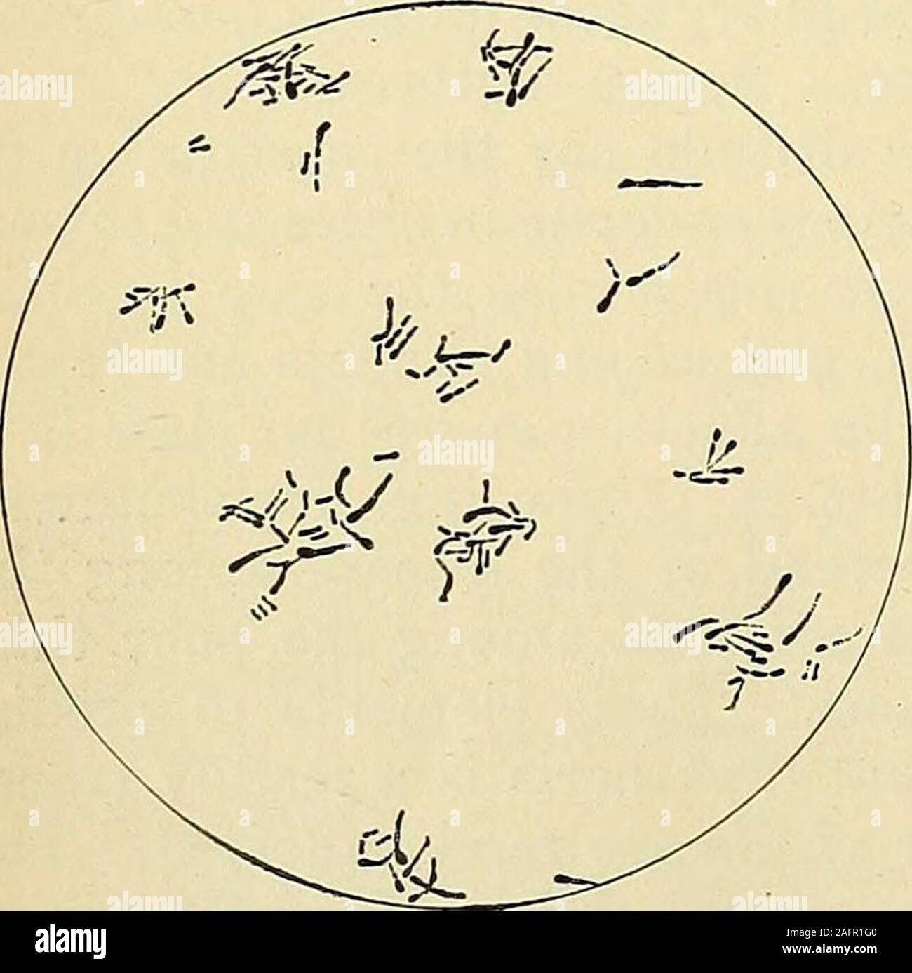 Klebs loffler hi-res stock photography and images - Alamy