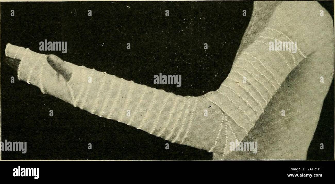 . Minor surgery and bandaging; including the treatment of fractures and ...