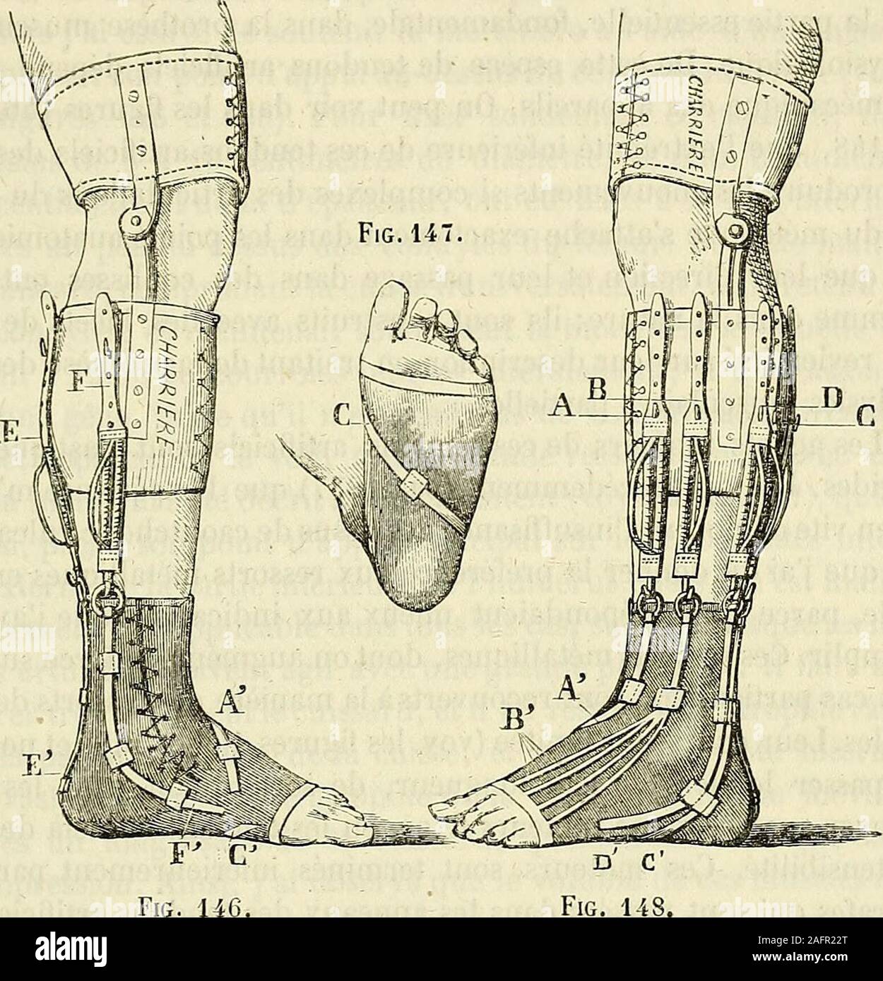 Pathologie du pied hi-res stock photography and images - Alamy