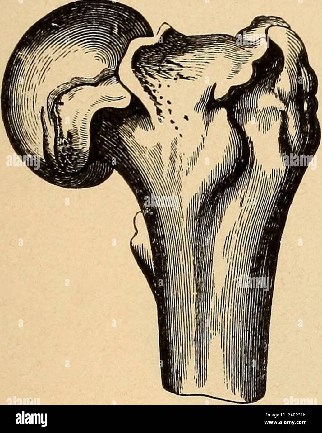 . A practical treatise on fractures and dislocations. Bony union after ...