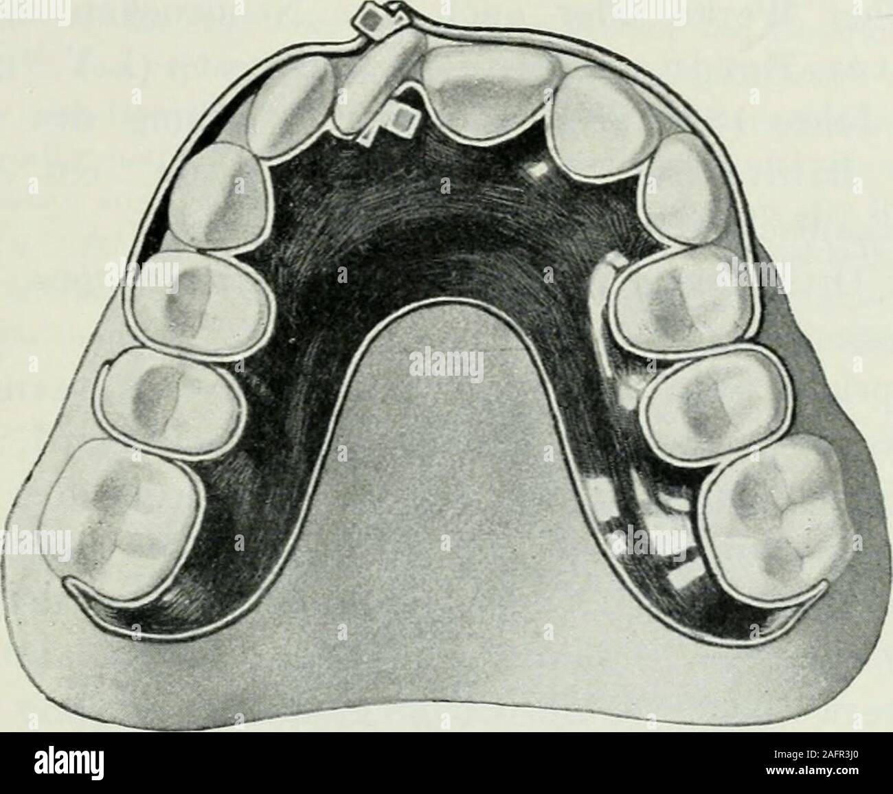 Schneidezahn hi-res stock photography and images - Alamy