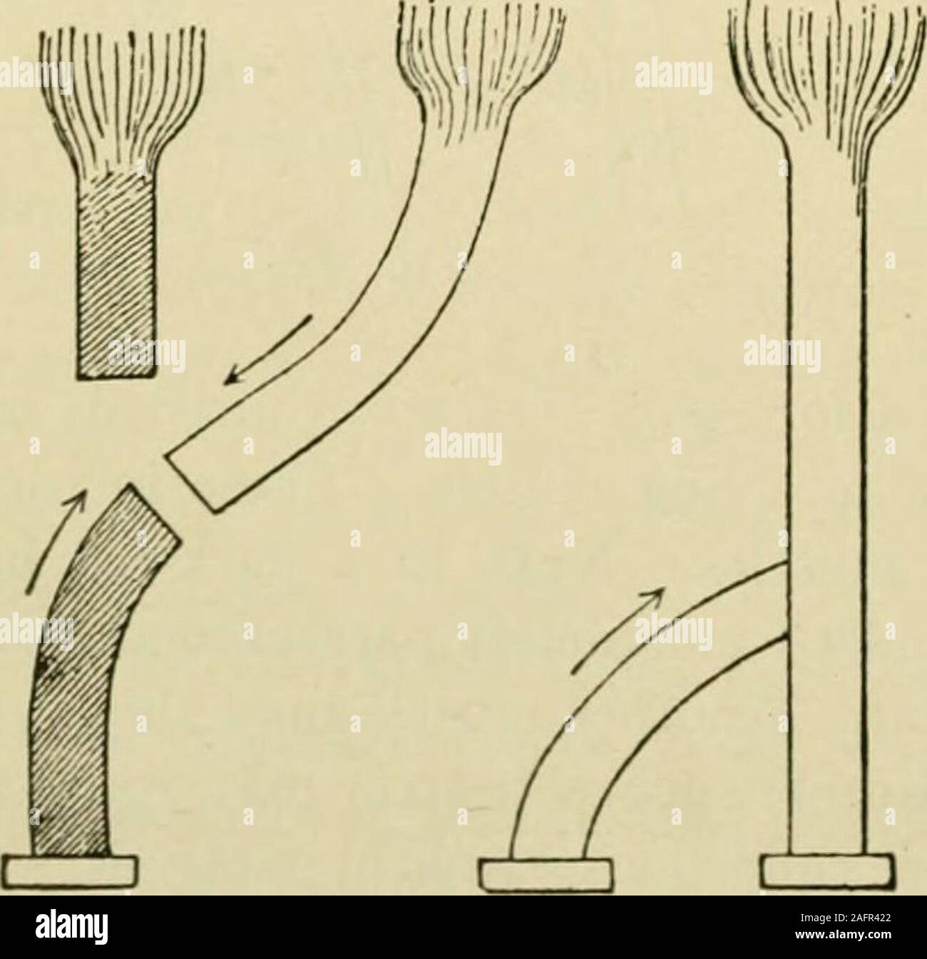 . Manual of operative surgery. Fig. 1524. Fig. 1525. Fig. 1526. A ...
