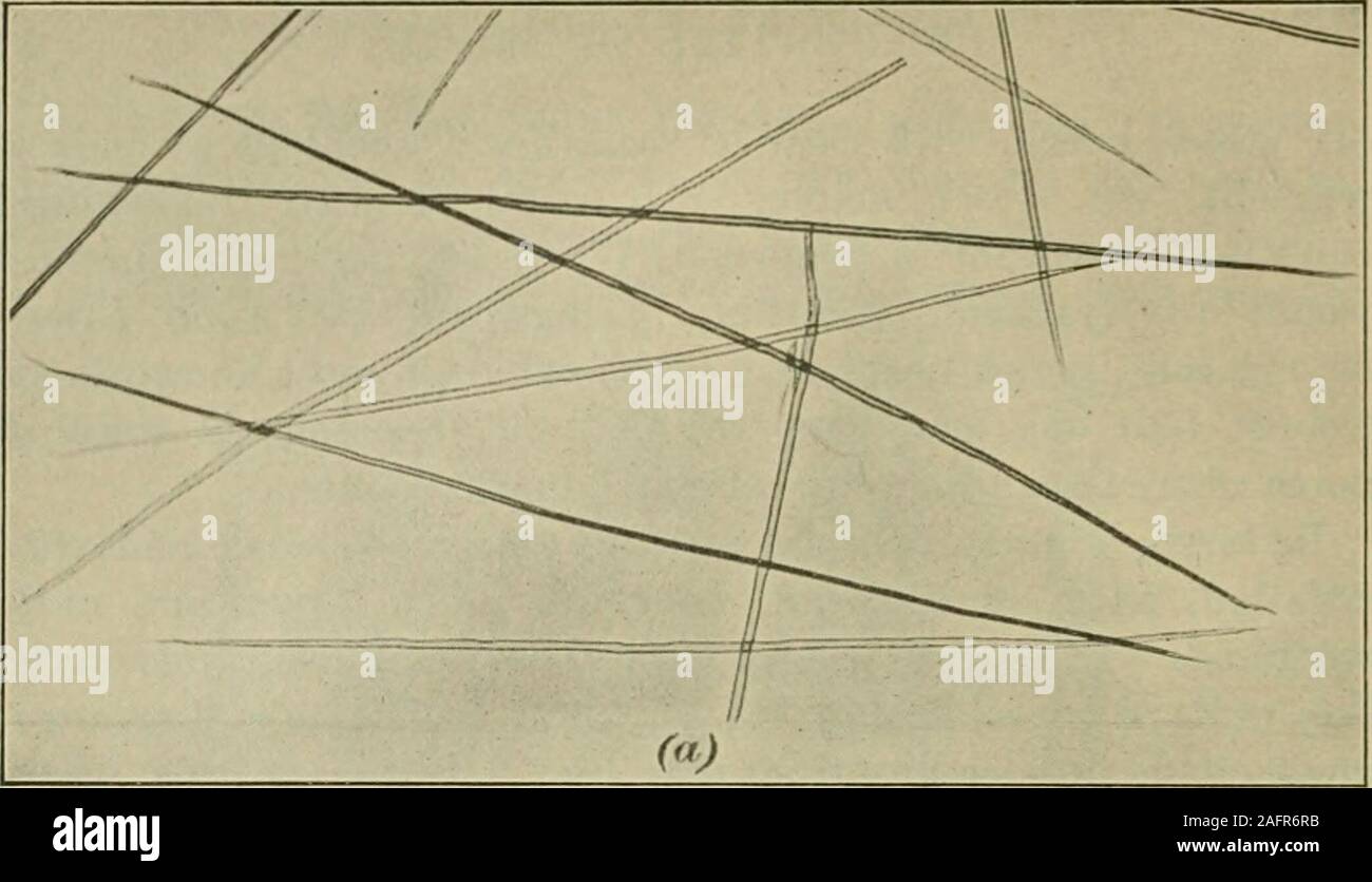Diffuse porous hi-res stock photography and images - Alamy