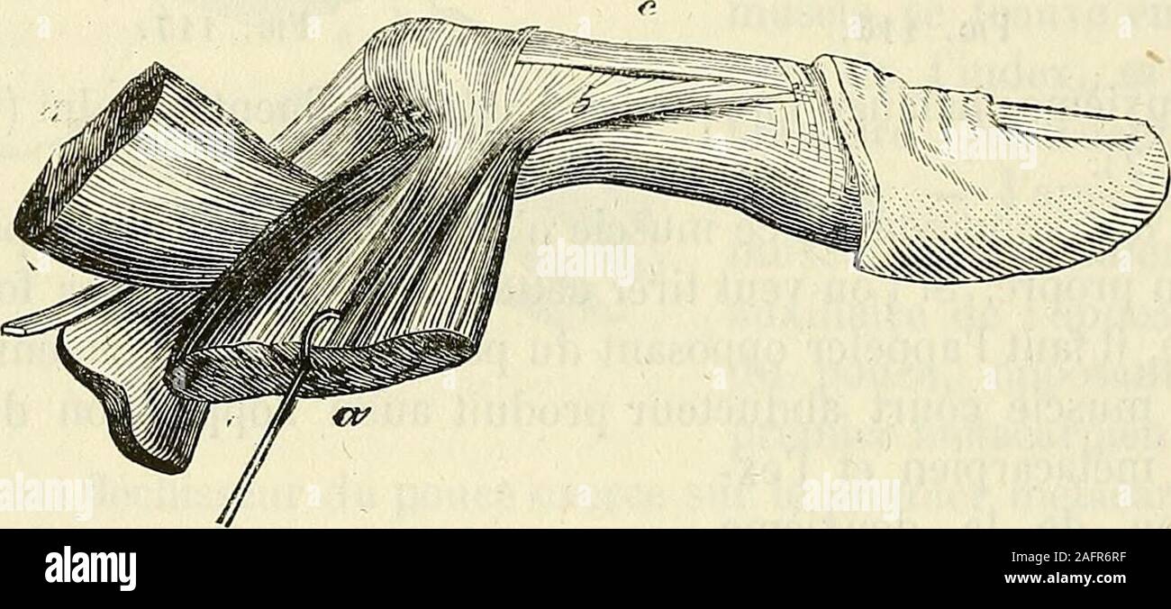 Les doigts et le pouce hi-res stock photography and images - Alamy