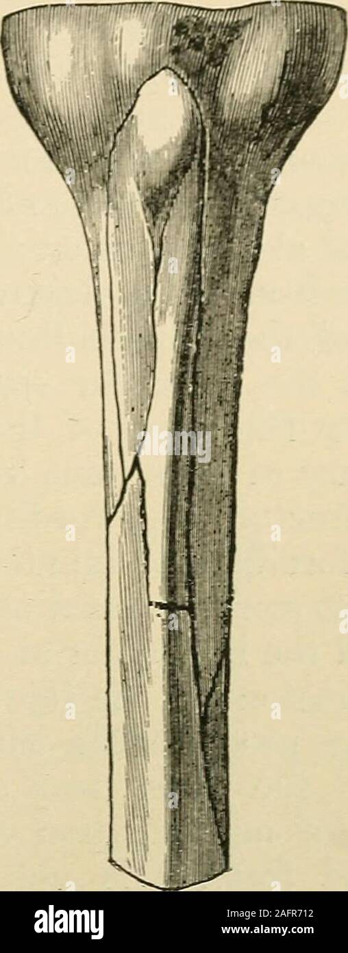 . Minor surgery and bandaging; including the treatment of fractures and ...