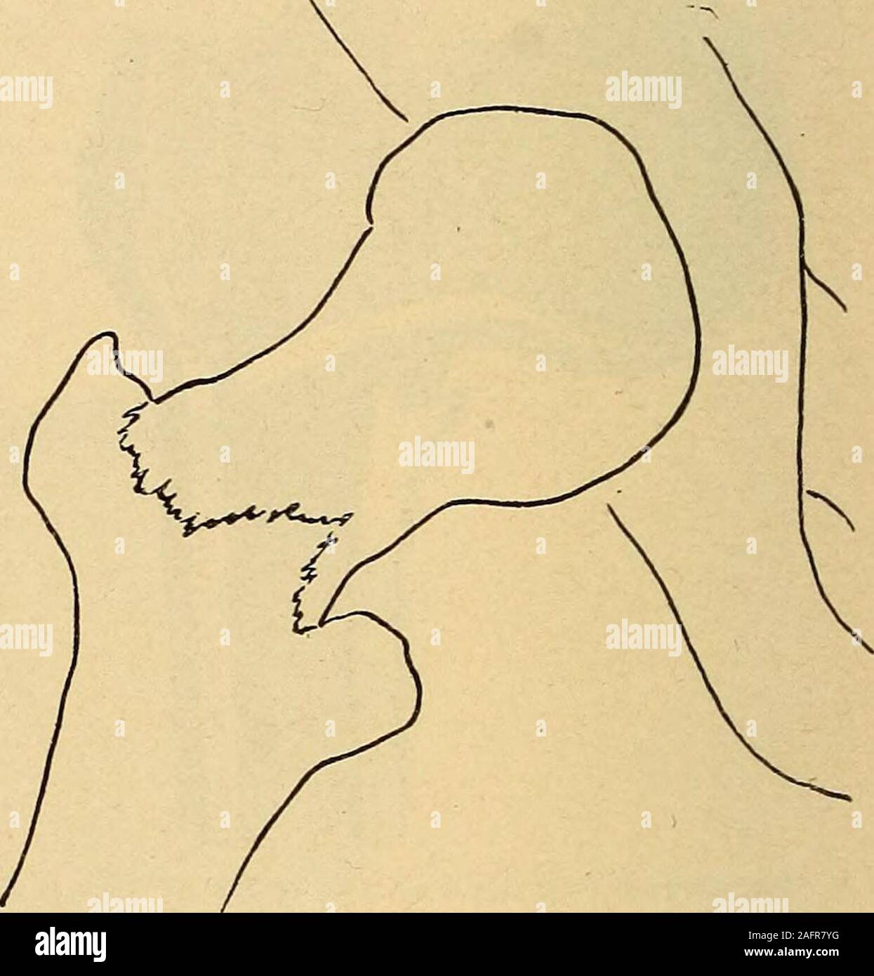. A practical treatise on fractures and dislocations. Fig. 240 Fig. 241 ...