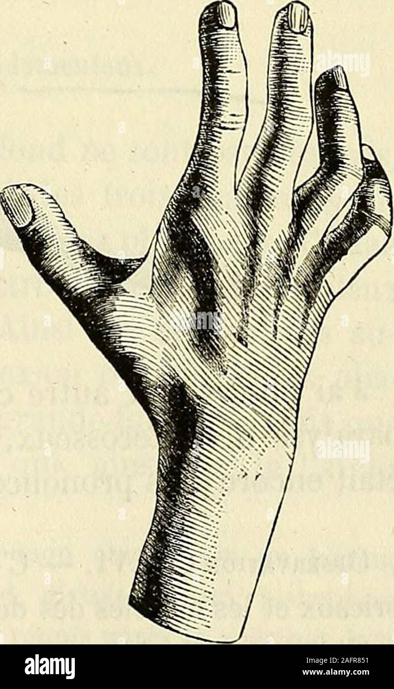 Phalanges de la main hi-res stock photography and images - Alamy