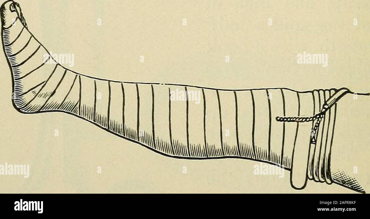 . Minor surgery and bandaging; including the treatment of fractures and ...