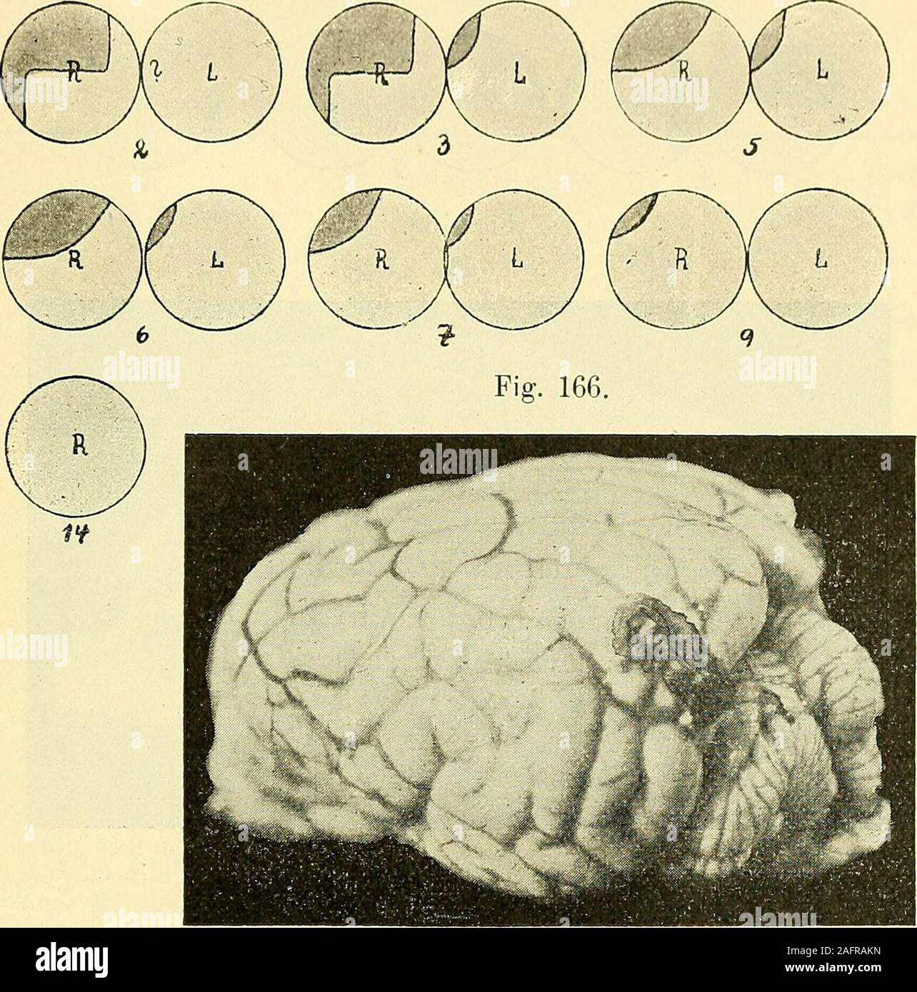 Gesichtsfelder hi-res stock photography and images - Alamy