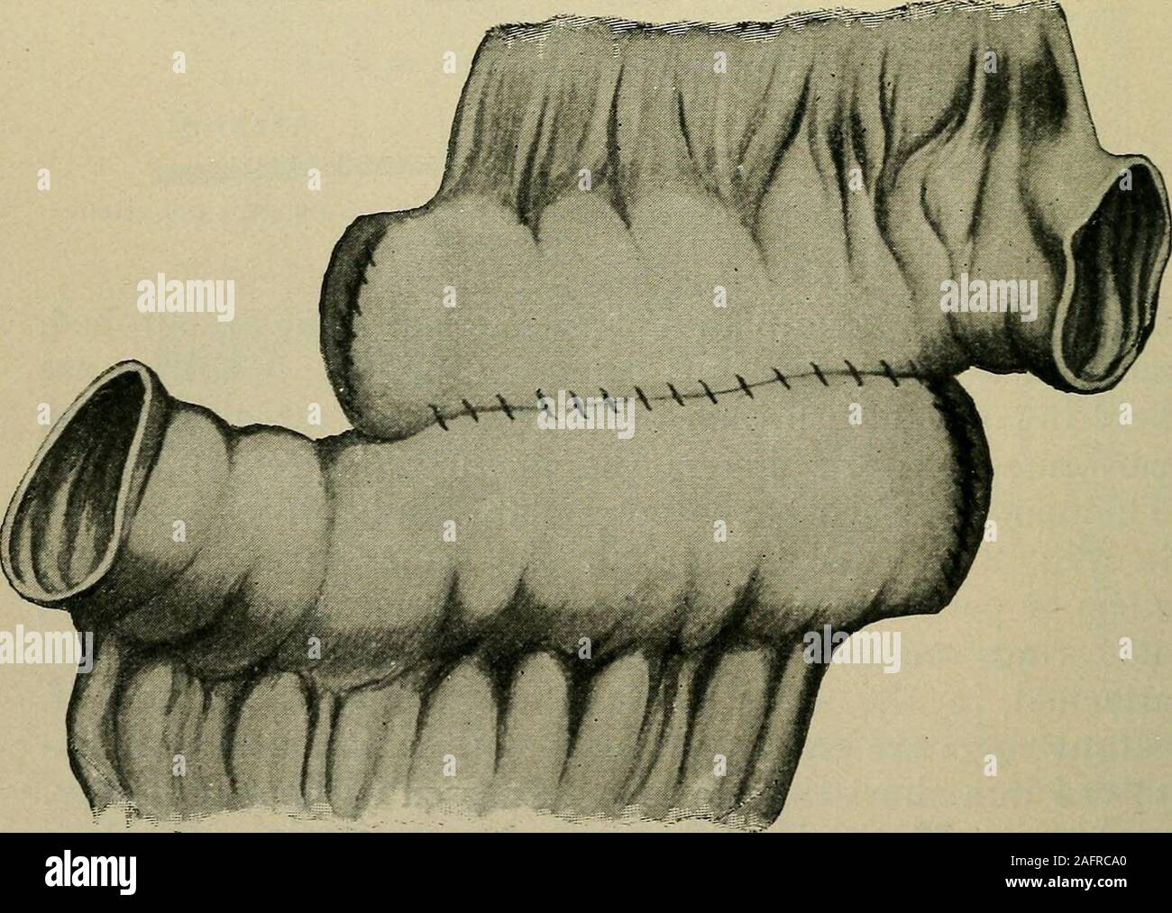 . Minor surgery and bandaging; including the treatment of fractures and ...