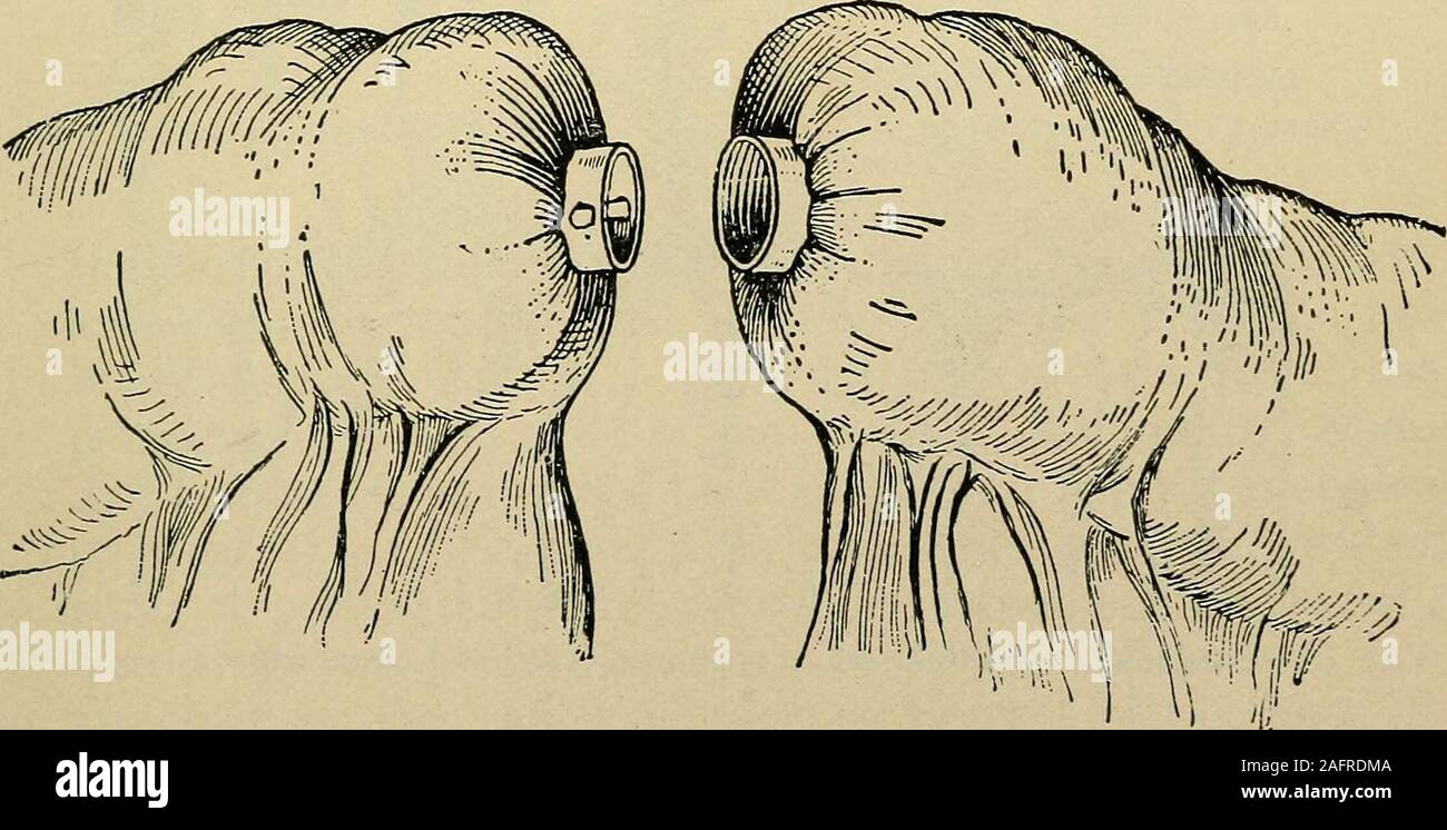 . Minor surgery and bandaging; including the treatment of fractures and ...