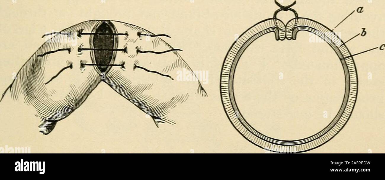 . Minor surgery and bandaging; including the treatment of fractures and ...