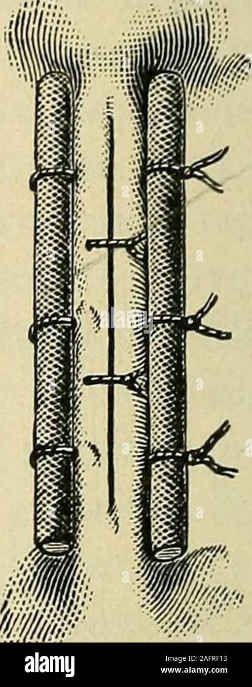 . Minor surgery and bandaging; including the treatment of fractures and ...
