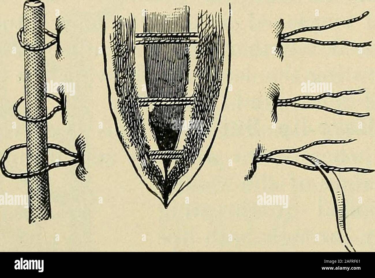 . Minor surgery and bandaging; including the treatment of fractures and ...
