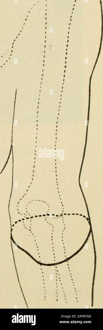 Shoulder loop hi-res stock photography and images - Alamy