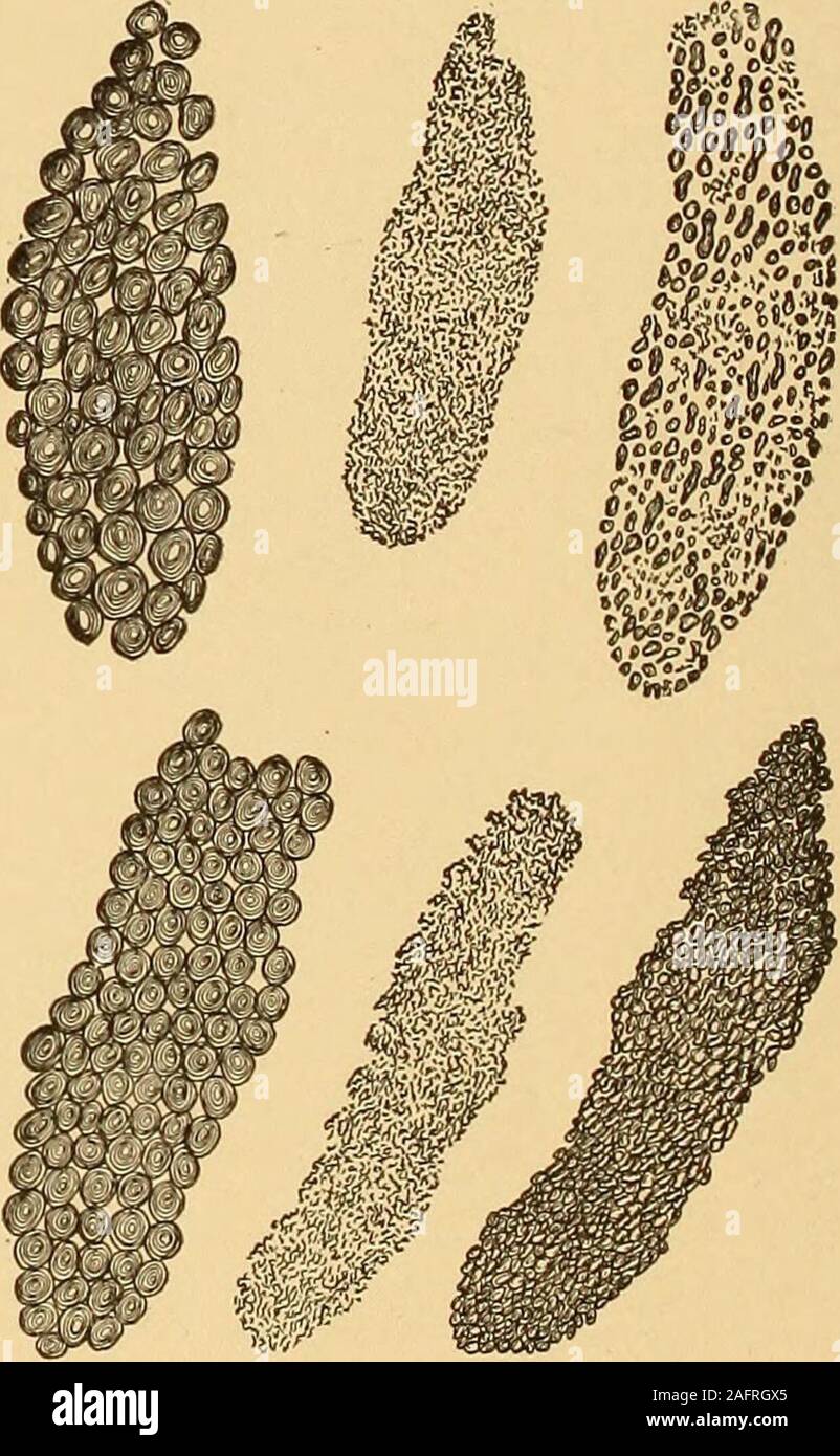 . Urinary analysis and diagnosis by microscopical and chemical ...