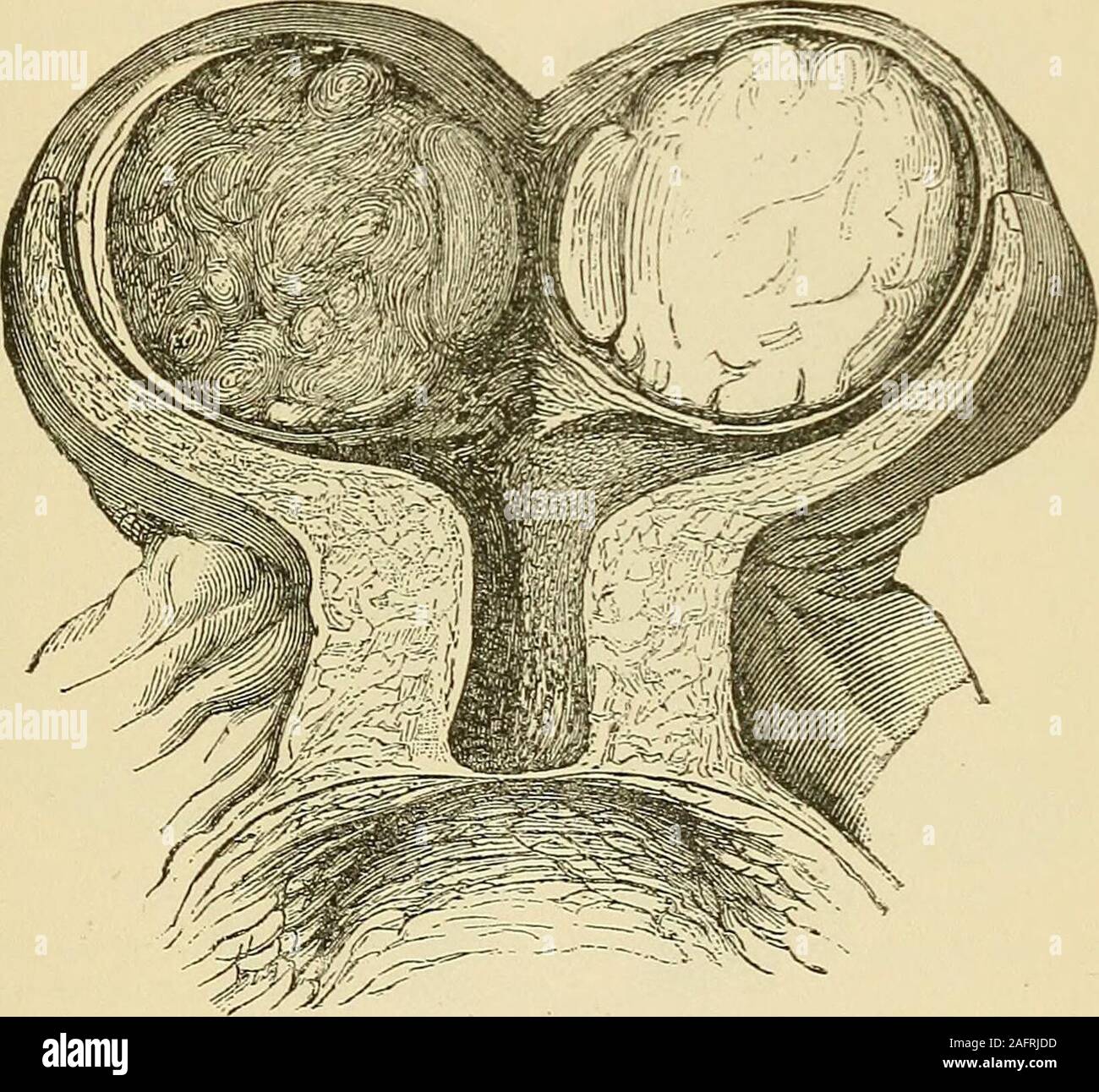 Fundus of uterus hi-res stock photography and images - Alamy