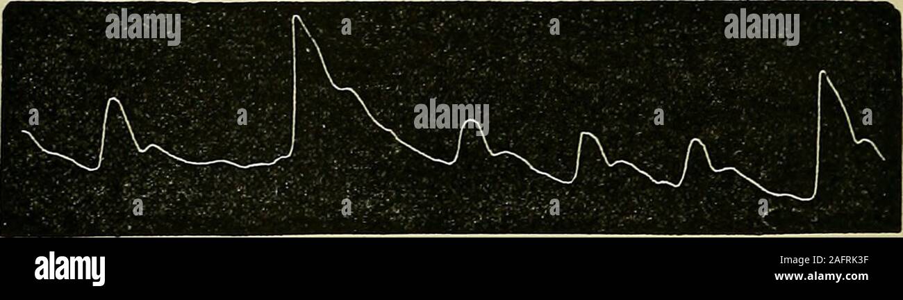 . Diseases of the heart and thoracic aorta. Fig. 117.Figs, i 16 and 117 ...
