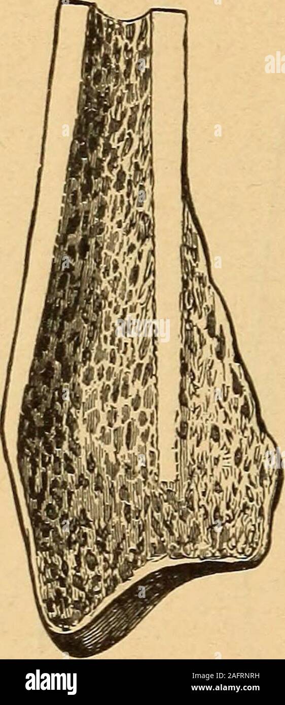 Callus formation hi-res stock photography and images - Alamy