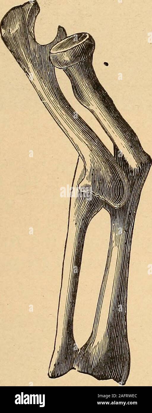 Callus formation hi-res stock photography and images - Alamy