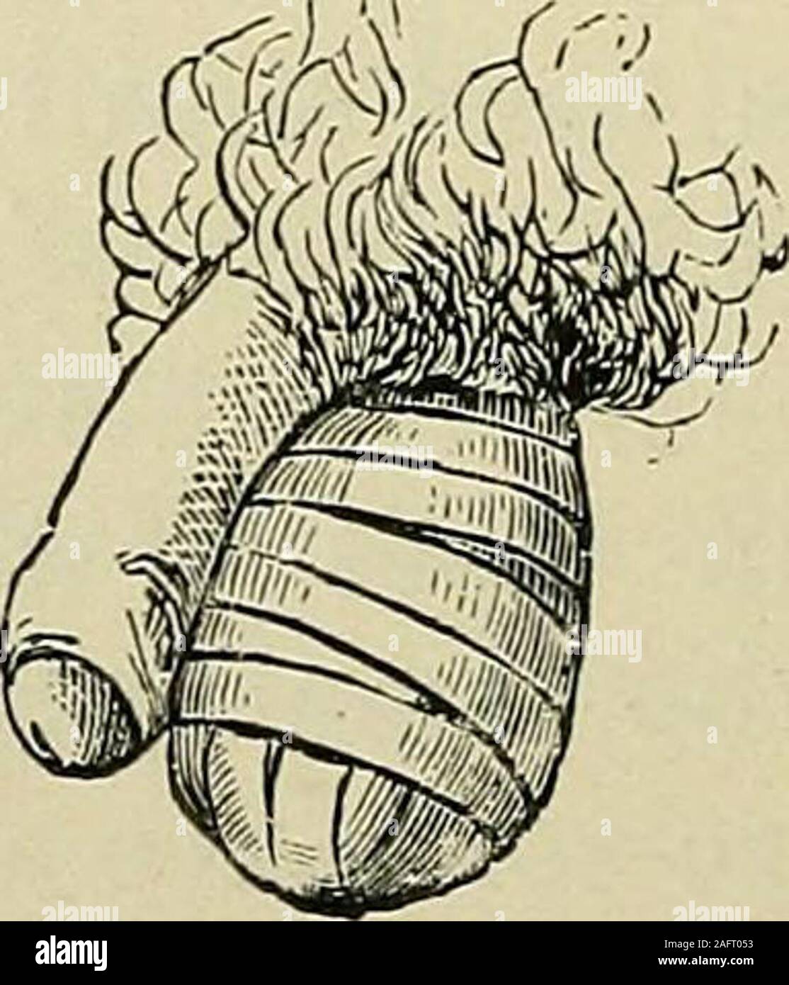 . Minor surgery and bandaging; including the treatment of fractures and ...