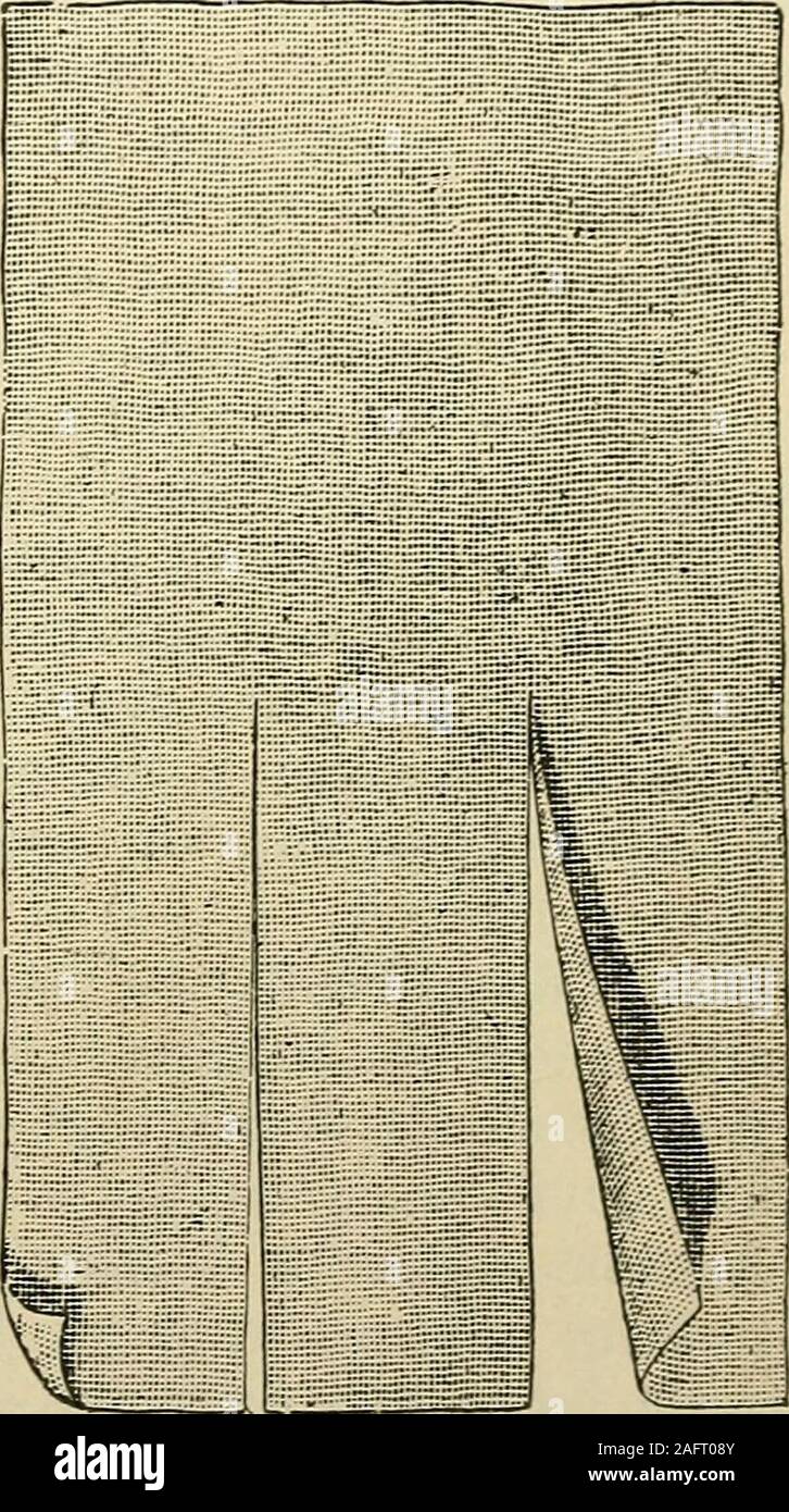 . Minor surgery and bandaging; including the treatment of fractures and ...