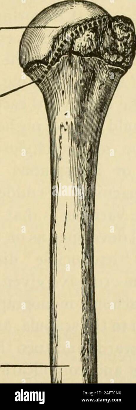Humeral head hi-res stock photography and images - Alamy