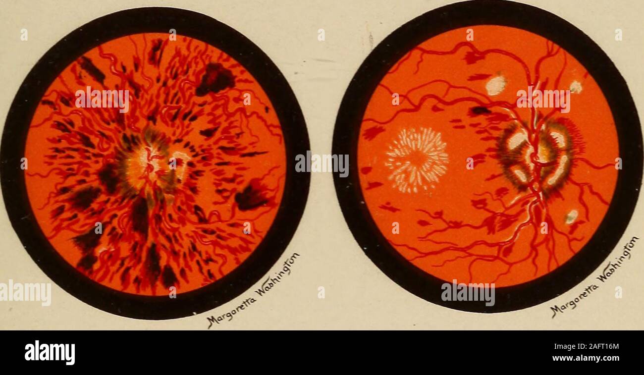 . Medical diagnosis for the student and practitioner. Fig. I. Normal ...