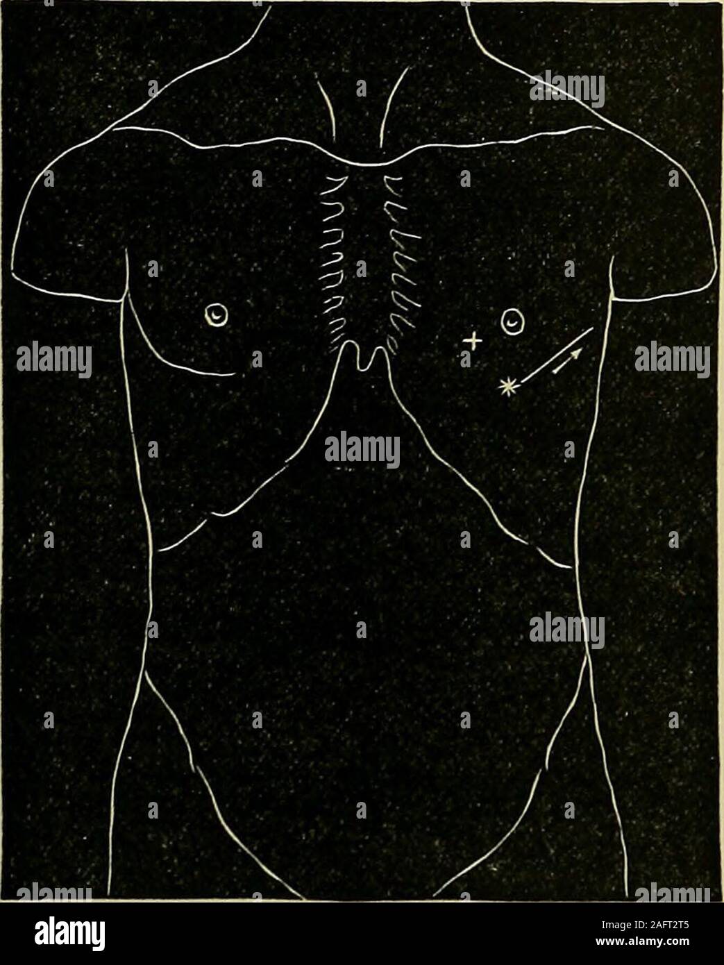 Heait hi-res stock photography and images - Alamy