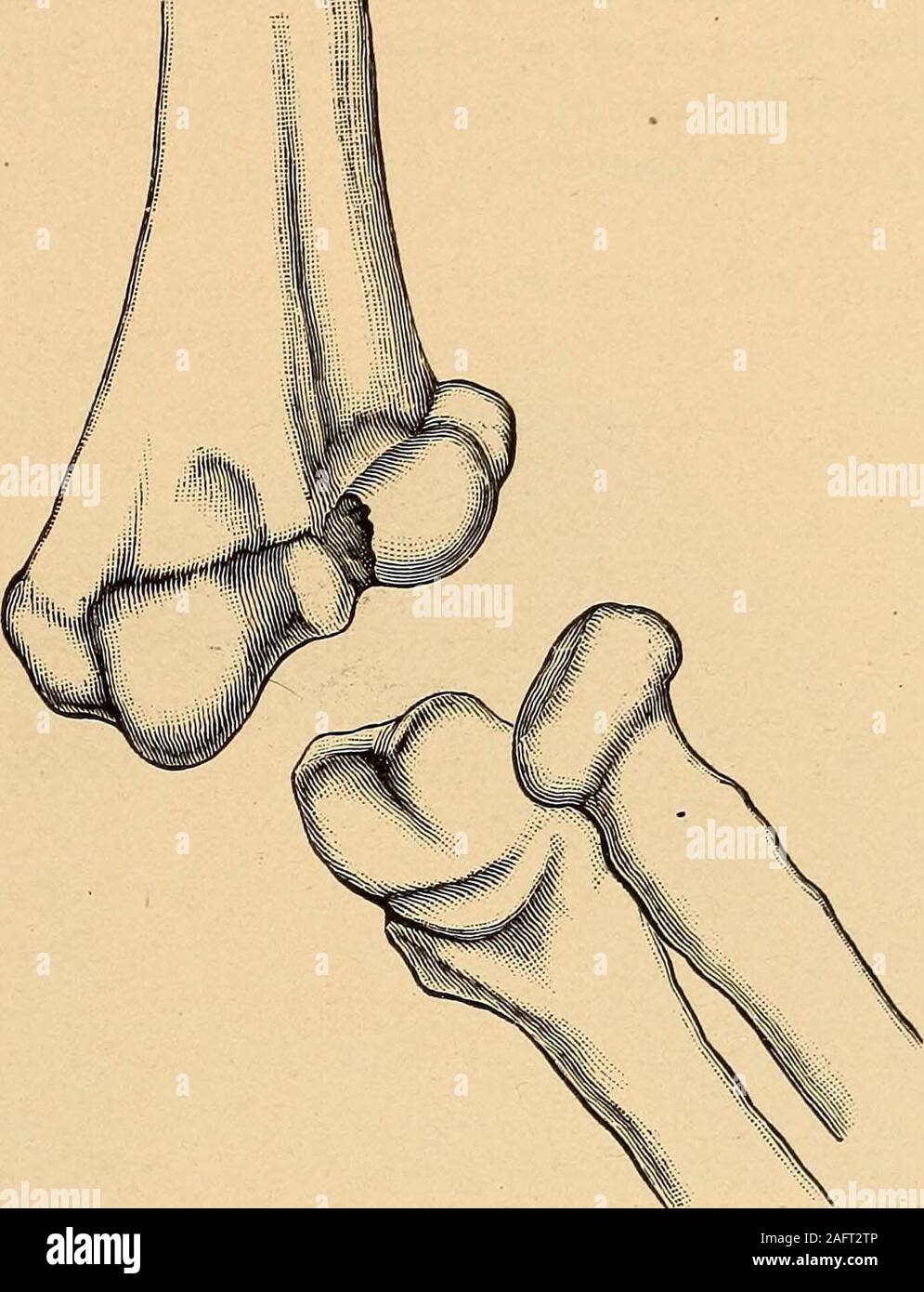 . A practical treatise on fractures and dislocations. )ation ; and if ...