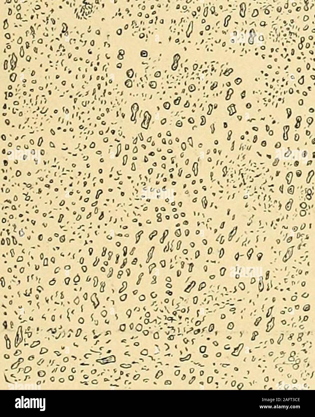 . Urinary analysis and diagnosis by microscopical and chemical ...