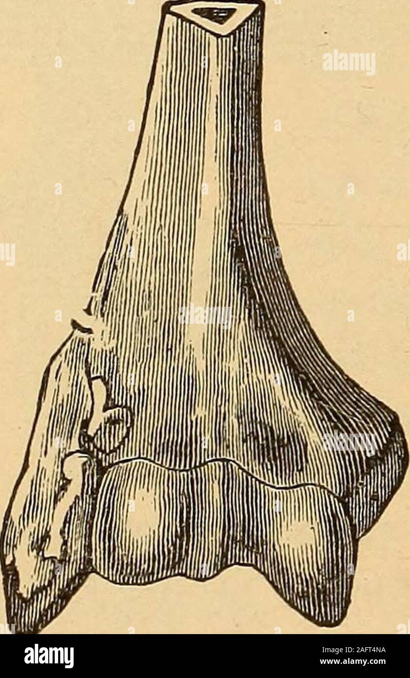Transfixion suture hi-res stock photography and images - Alamy
