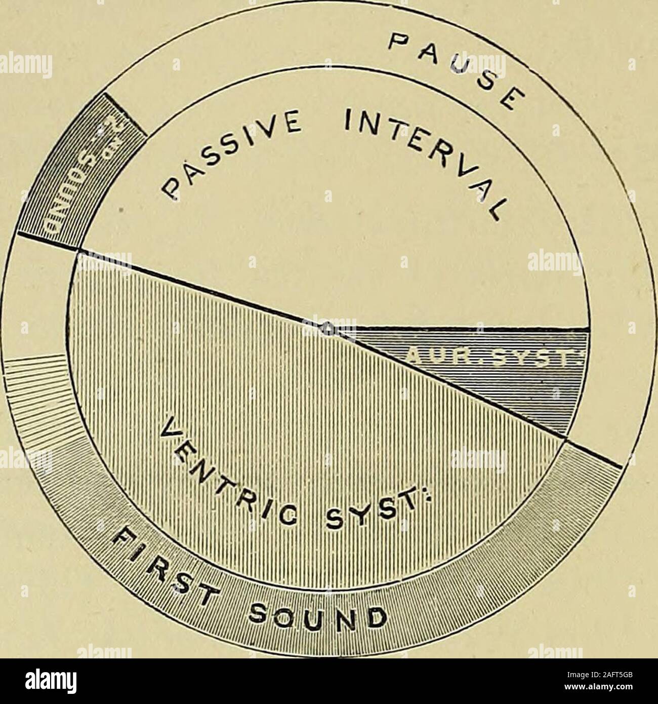 . Diseases of the heart and thoracic aorta. Fig. 36,—Diagrammatic ...
