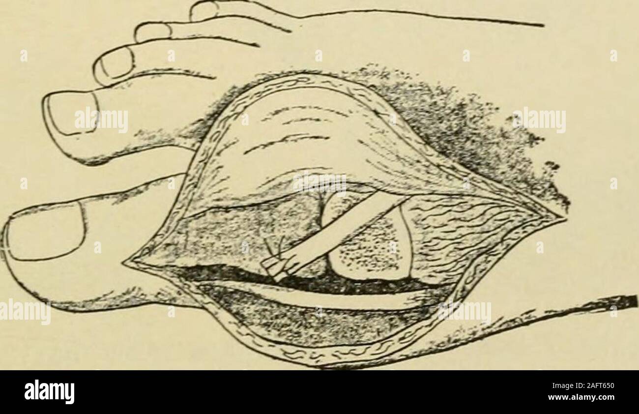 Curved weir hi-res stock photography and images - Alamy