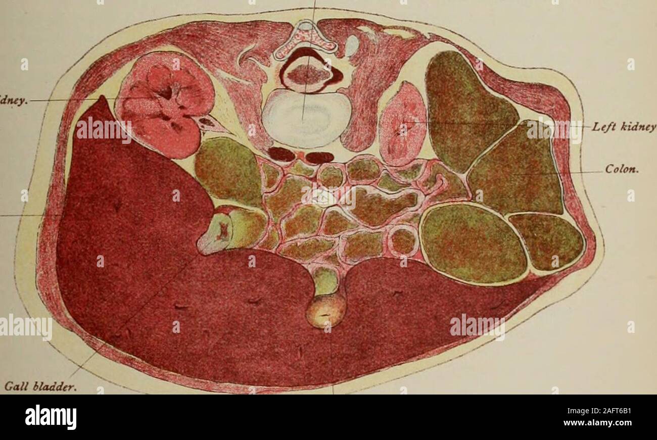 . Manual of antenatal pathology and hygiene : the foetus. Plate vi ...