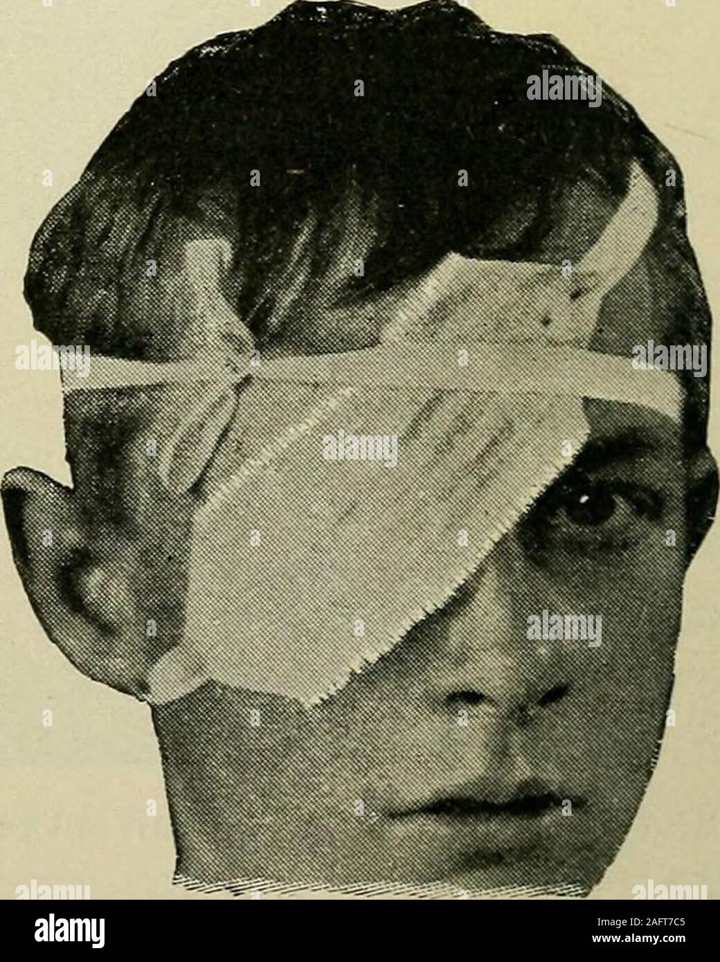 Eye Bandage Stock Photos & Eye Bandage Stock Images - Alamy