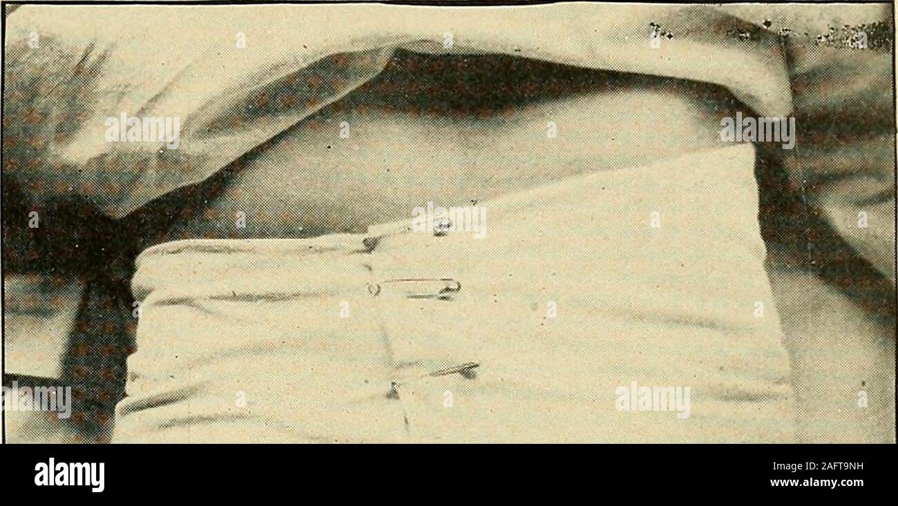 . The diagnosis and treatment of diseases of women. Fig. 682. The ...