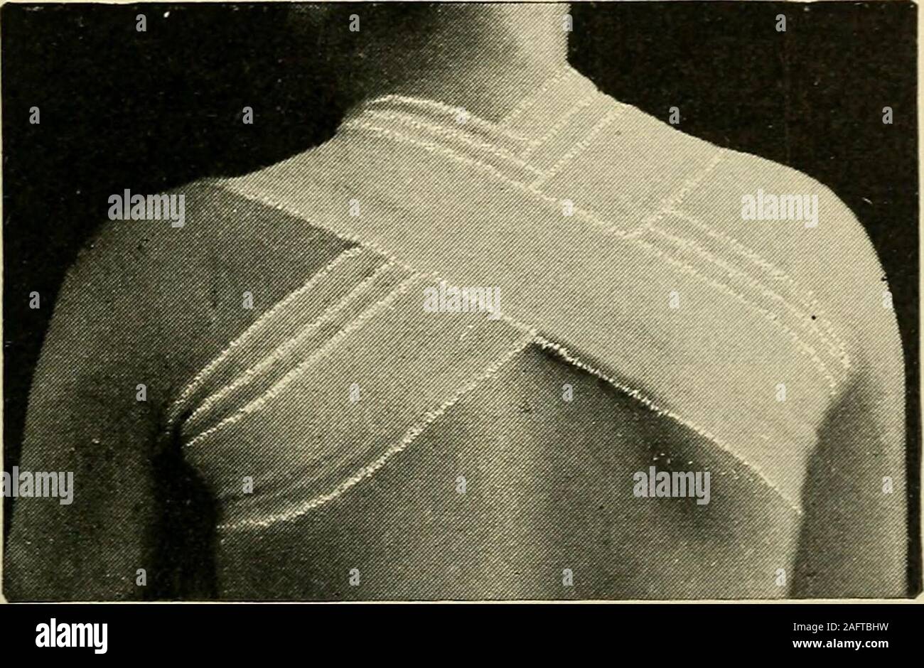 . Minor surgery and bandaging; including the treatment of fractures and ...