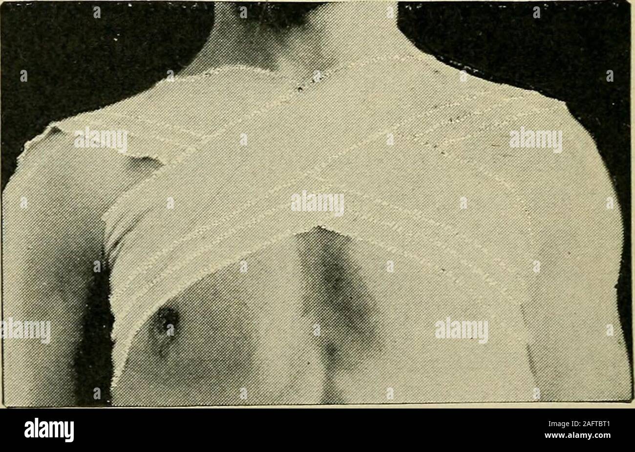 . Minor surgery and bandaging; including the treatment of fractures and ...