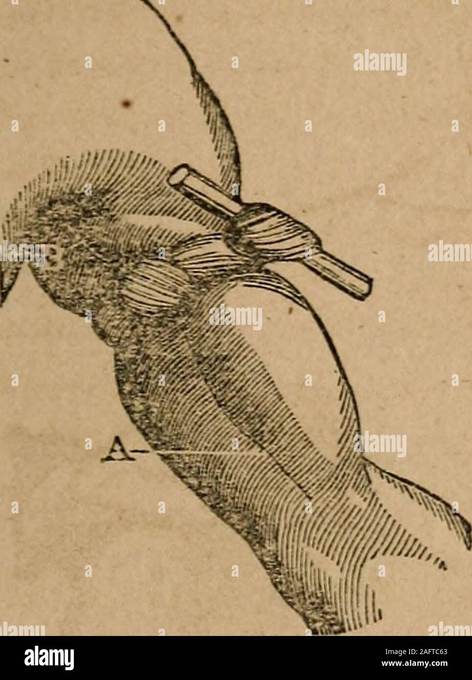 Bone twist hi-res stock photography and images - Alamy